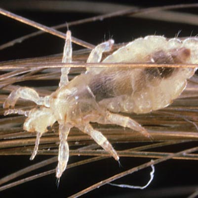 Traitement contre les poux : quoi faire ? - Infos coiffure